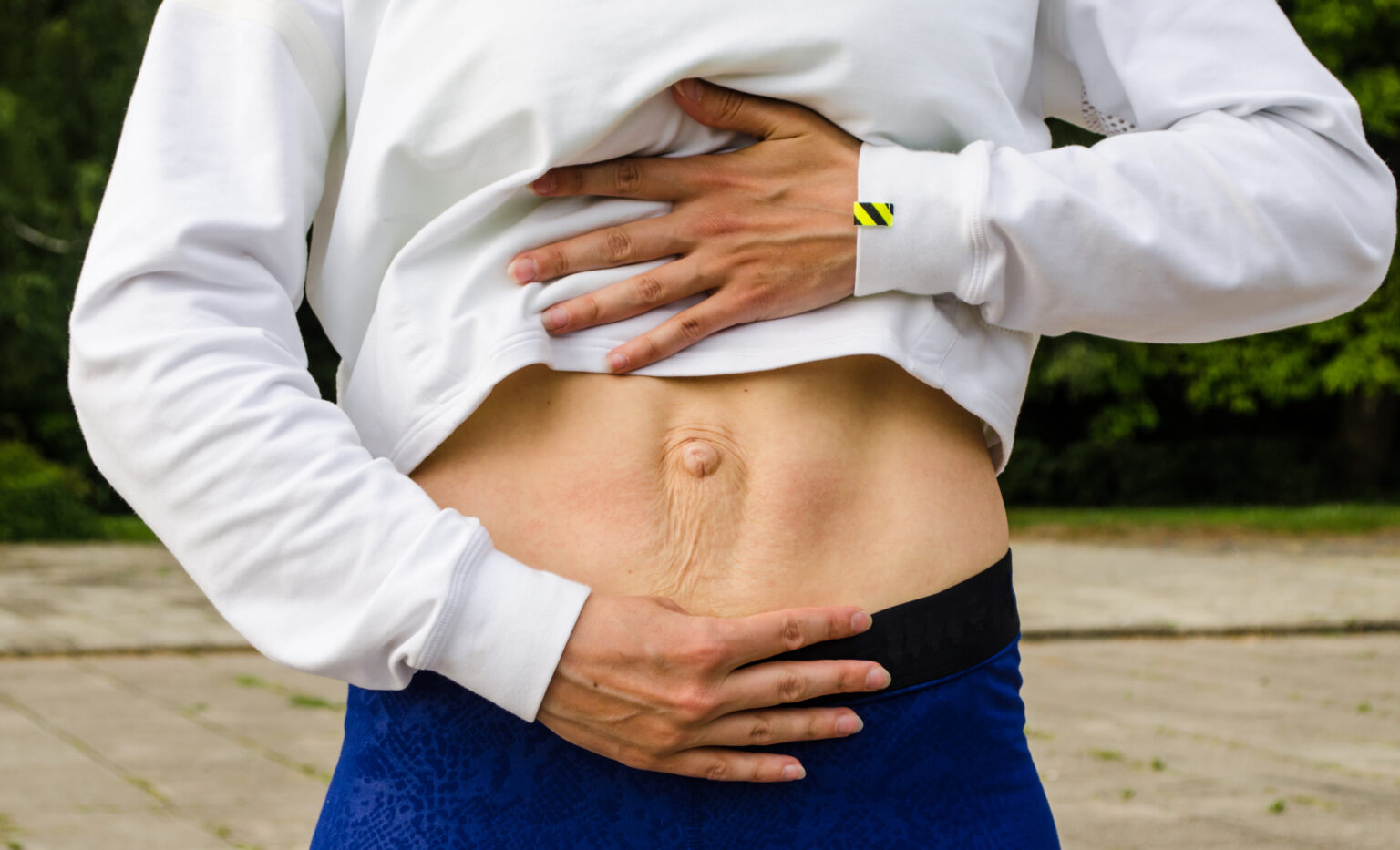 A Complete Guide to Diastasis Recti: Heal and Rebuild